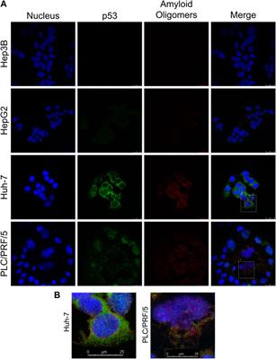 Frontiers | PRIMA-1 inhibits Y220C p53 amyloid aggregation and ...