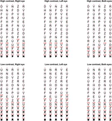 Frontiers | Binocular summation in high and low contrast letter acuities