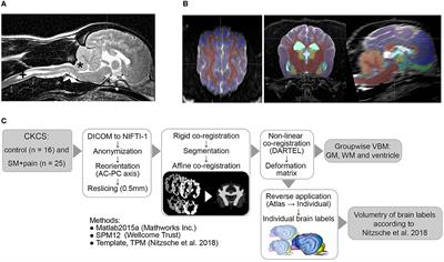 Frontiers in Neuroanatomy | Articles