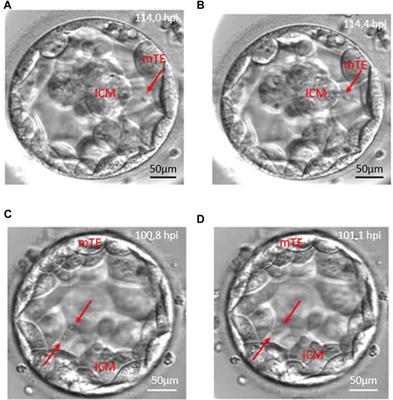 Frontiers | The importance of cytoplasmic strings during early human ...