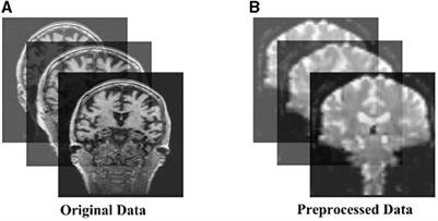 Frontiers | A deep learning framework for identifying Alzheimer's ...