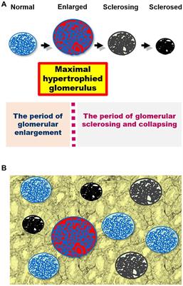 Frontiers | Glomerular hyperfiltration and hypertrophy: an evaluation ...