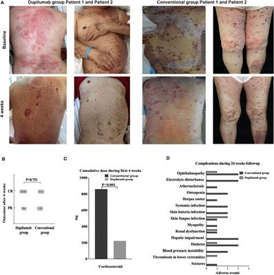Frontiers | Dupilumab effectively and rapidly treats bullous pemphigoid ...