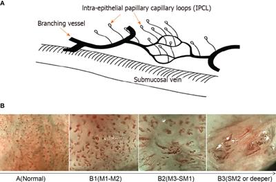 Frontiers | The current state of artificial intelligence in endoscopic ...