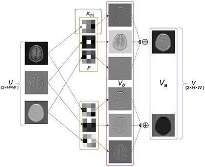 Frontiers | Linear fine-tuning: a linear transformation based transfer ...