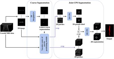 Frontiers | Joint 2D–3D cross-pseudo supervision for carotid vessel ...