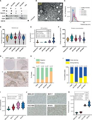 Frontiers | Serum-derived extracellular vesicles from breast cancer ...