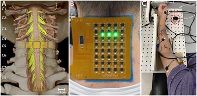 Frontiers | Targeted transcutaneous spinal cord stimulation promotes ...