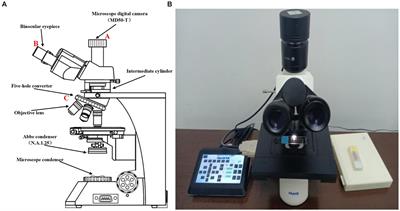 Frontiers | Focus prediction of medical microscopic images based on ...