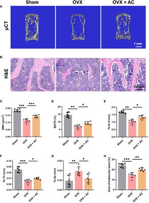 Frontiers | Aconine attenuates osteoclast-mediated bone resorption and ...