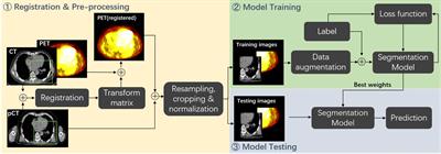Frontiers | A deep learning approach for automatic tumor delineation in ...