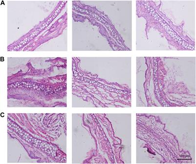 Frontiers | Anti-inflammatory and analgesic effects of Streblus indicus