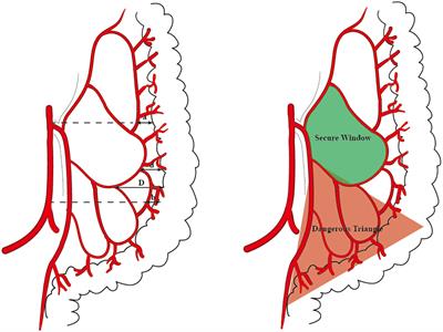 Frontiers | The value of ICG-guided left colon vascular variation and ...