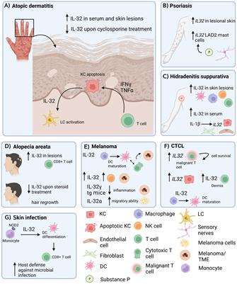 Frontiers | IL-32 as a potential biomarker and therapeutic target in ...