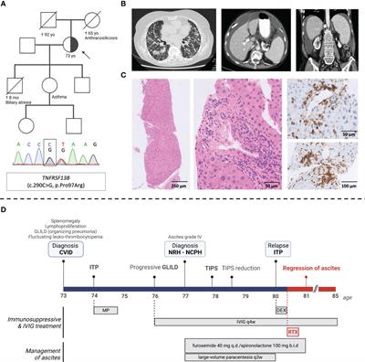 Frontiers | Rituximab and improved nodular regenerative hyperplasia ...