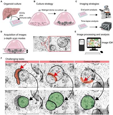 Frontiers | Analysis of organoid and immune cell co-cultures by machine ...