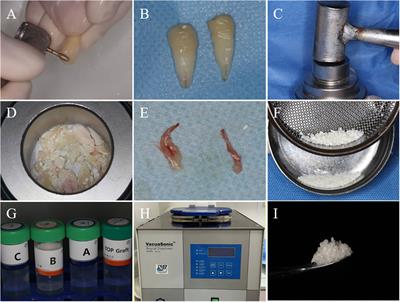 Frontiers | Demineralized dentin matrix promotes gingival healing in ...