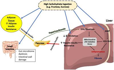 Frontiers | Metabolic-associated fatty liver disease: a selective ...