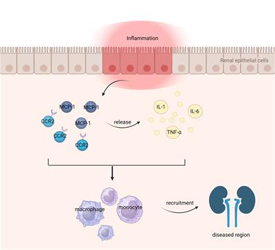 Frontiers | Role of MCP-1 as an inflammatory biomarker in nephropathy
