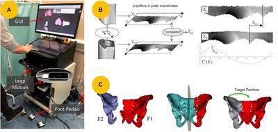 Frontiers | Technologies evolution in robot-assisted fracture reduction ...