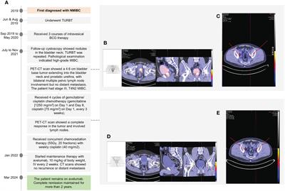 Frontiers | Avelumab maintenance therapy for node-positive muscle ...