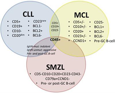Marginal Zone Lymphoma Diagram