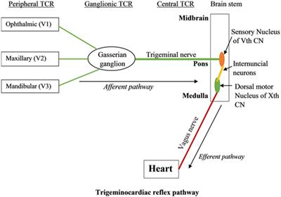 Frontiers | Sudden Infant Death Syndrome – Role of Trigeminocardiac ...