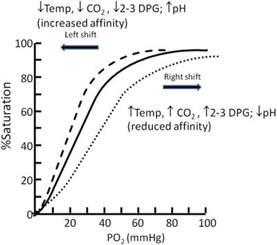 Methemoglobinemia Oxygen Dissociation Curve