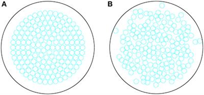 Frontiers | Spatiotemporal Dynamics of Insulitis in Human Type 1 Diabetes