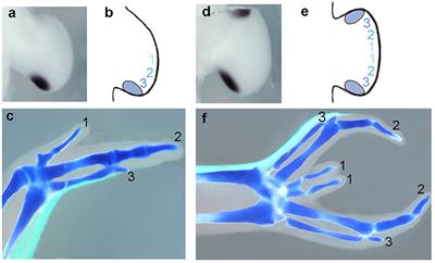 Sonic Hedgehog Protein Mutation