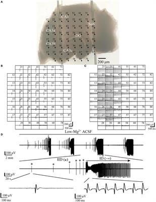 Frontiers | The Subiculum: A Potential Site of Ictogenesis in a ...