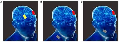 Frontiers | Modulation of Brain Activity with Noninvasive Transcranial ...