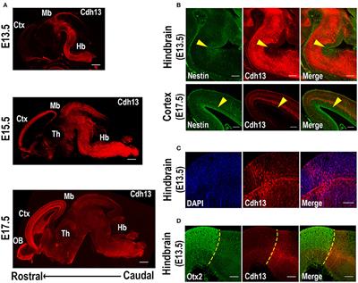Frontiers | Cadherin-13 Deficiency Increases Dorsal Raphe 5-HT Neuron ...