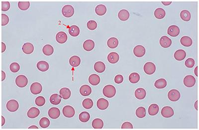 Frontiers | First Molecular Detection of Babesia gibsoni in Dogs from ...