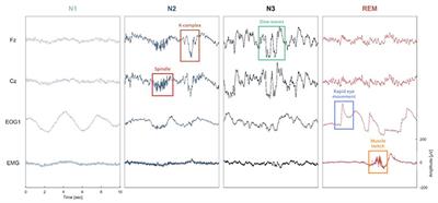 Frontiers | Sleep: An Open-Source Python Software for Visualization ...
