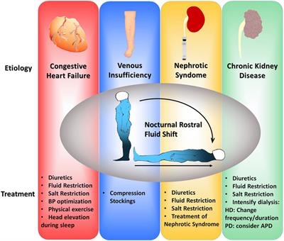 Frontiers | Fluid Redistribution in Sleep Apnea: Therapeutic ...