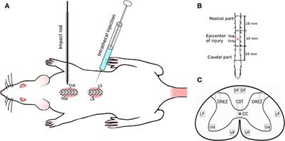 Frontiers | Spinal Cord Molecular and Cellular Changes Induced by ...