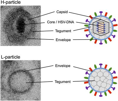 Frontiers | Role of L-Particles during Herpes Simplex Virus Infection