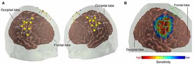 Frontiers | Signal Processing in Functional Near-Infrared Spectroscopy ...