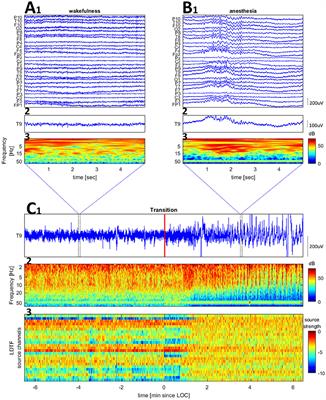 Frontiers | Distinguishing Anesthetized from Awake State in Patients: A ...