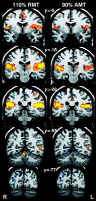 Frontiers | Combined rTMS/fMRI Studies: An Overlooked Resource in ...