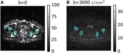 Frontiers | Microstructure Characterization of Bone Metastases from ...