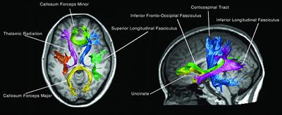 Frontiers | Age Related Changes in Topological Properties of Brain ...