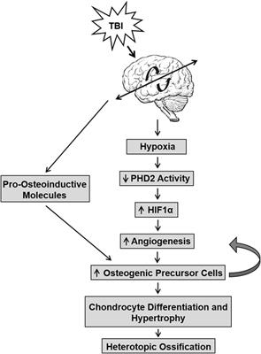 Frontiers | Long-term Consequences of Traumatic Brain Injury in Bone ...