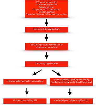 Pulmonary Arterial Hypertension Pathophysiology