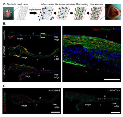 Frontiers | Can We Grow Valves Inside the Heart? Perspective on ...
