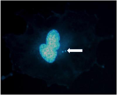 Frontiers | Radiation-Induced Chromosomal Aberrations and Immunotherapy ...