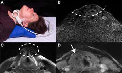 Frontiers | Improvements in High Resolution Laryngeal Magnetic ...