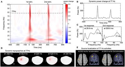 Frontiers | Aberrant Sensory Gating of the Primary Somatosensory Cortex ...