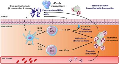 Bacterial Pneumonia Cell